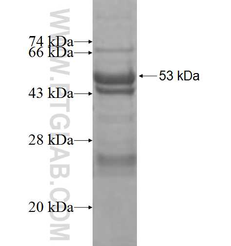 AAK1 Fusion Protein Ag7599 | Proteintech