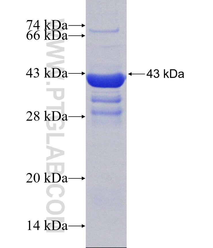 ABCB11 Fusion Protein Ag29427 | Proteintech