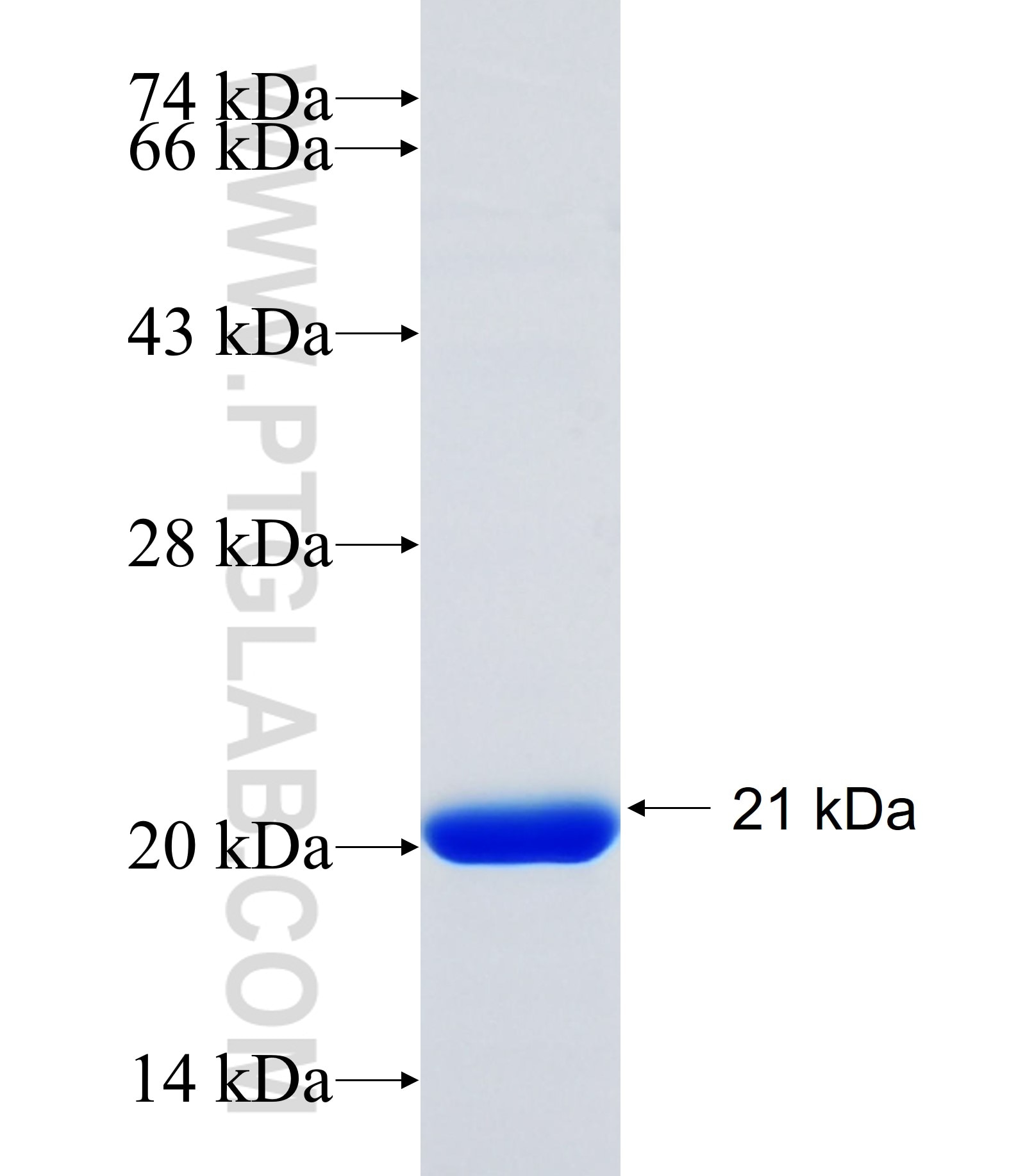ACAP1 Fusion Protein Ag34331 | Proteintech