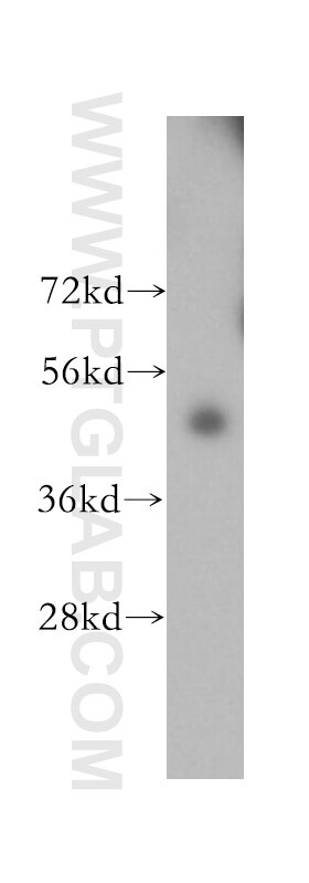 ACSM3 antibody (10168-2-AP) | Proteintech