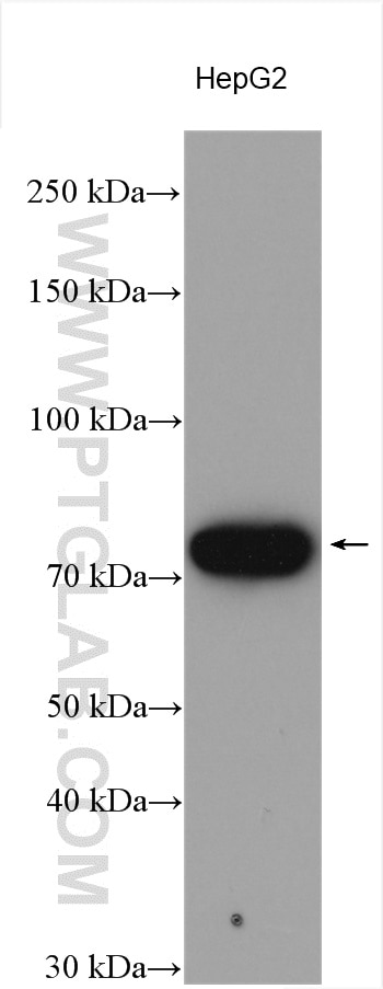 ACSS3 antibody (16204-1-AP) | Proteintech