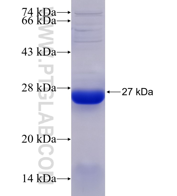 ACTG1 Fusion Protein Ag31029 | Proteintech