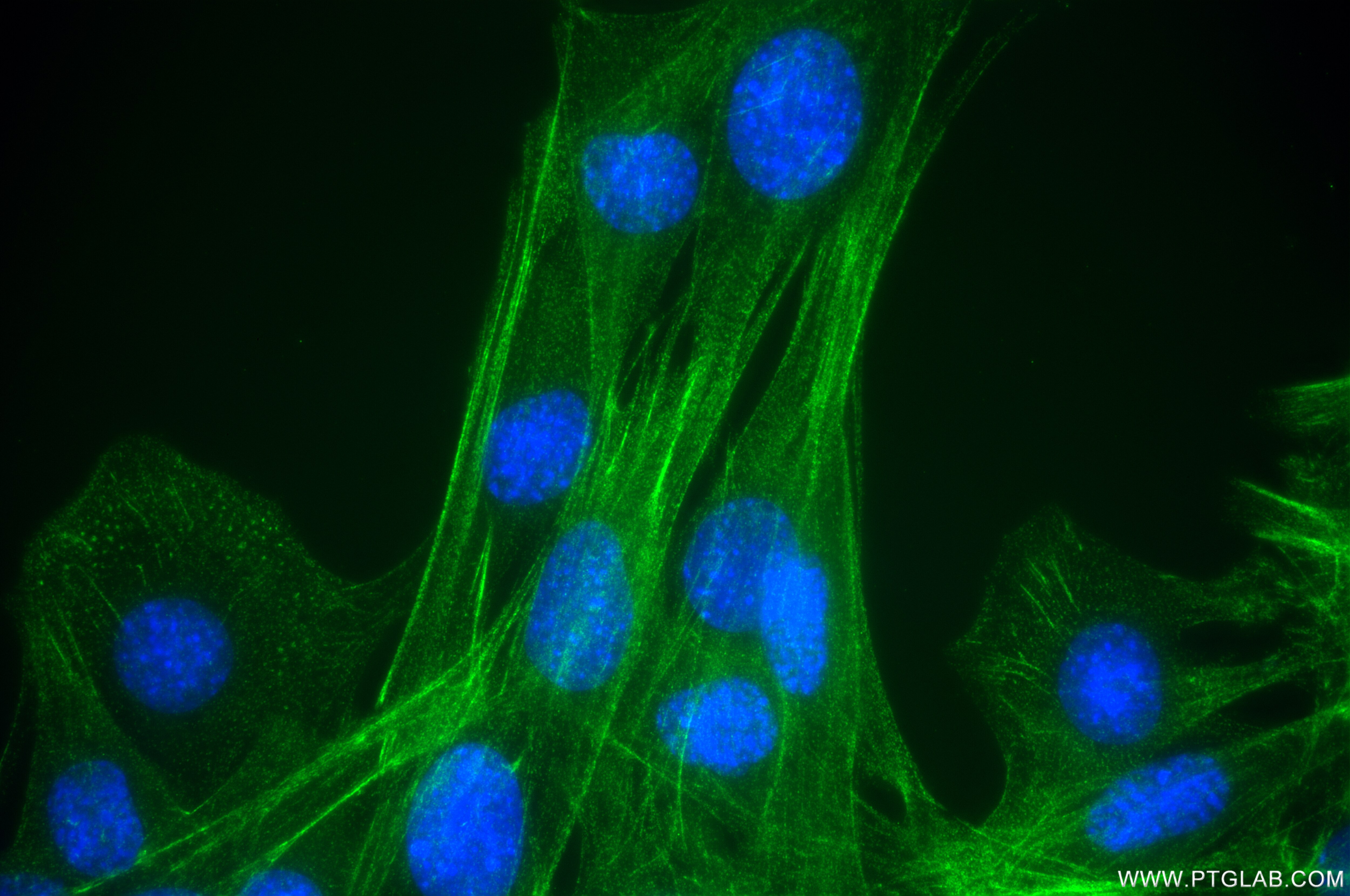 ACTN2 antibody (85857-4-RR) | Proteintech