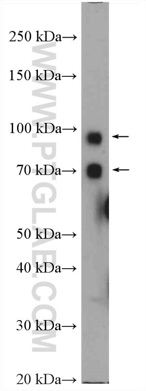 ADAM10 antibody (25900-1-AP) | Proteintech