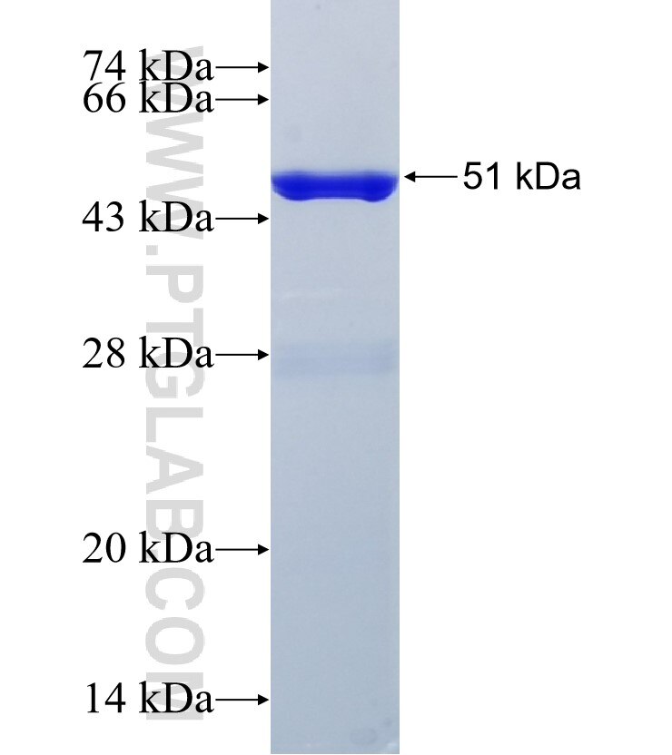 ADISSP Fusion Protein Ag34862 | Proteintech