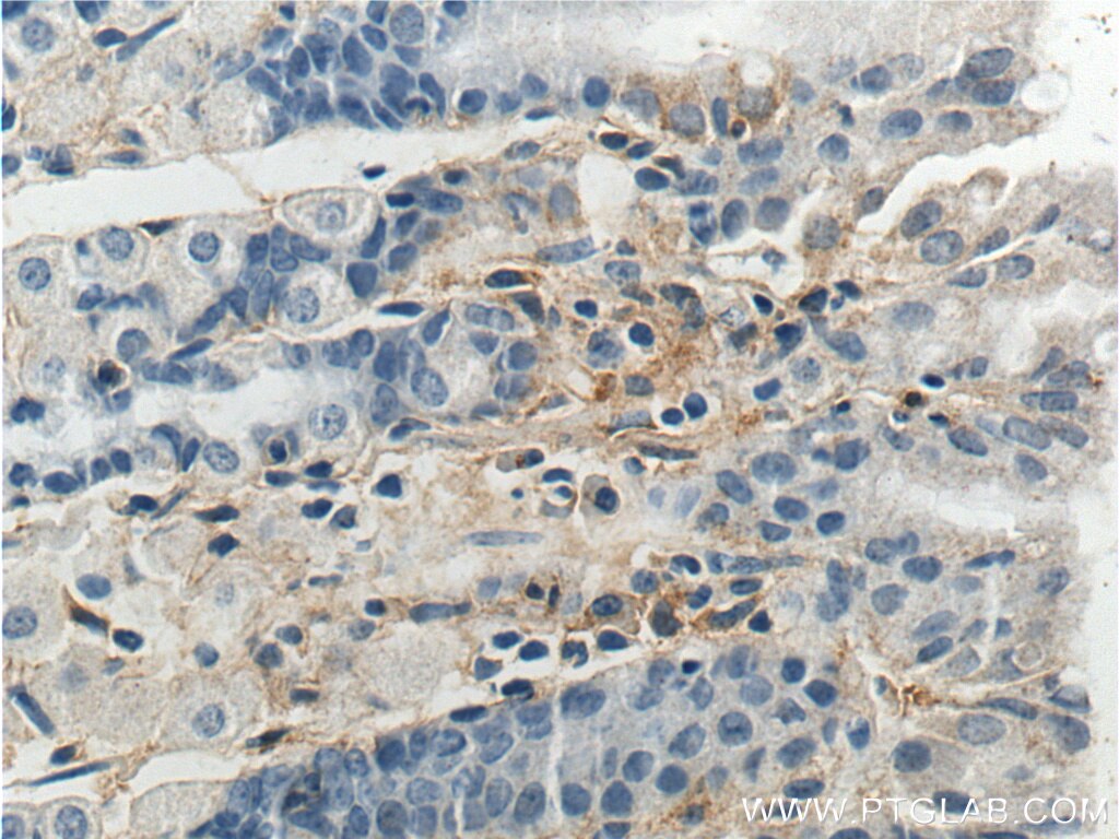 ADM2 antibody (23781-1-AP) | Proteintech