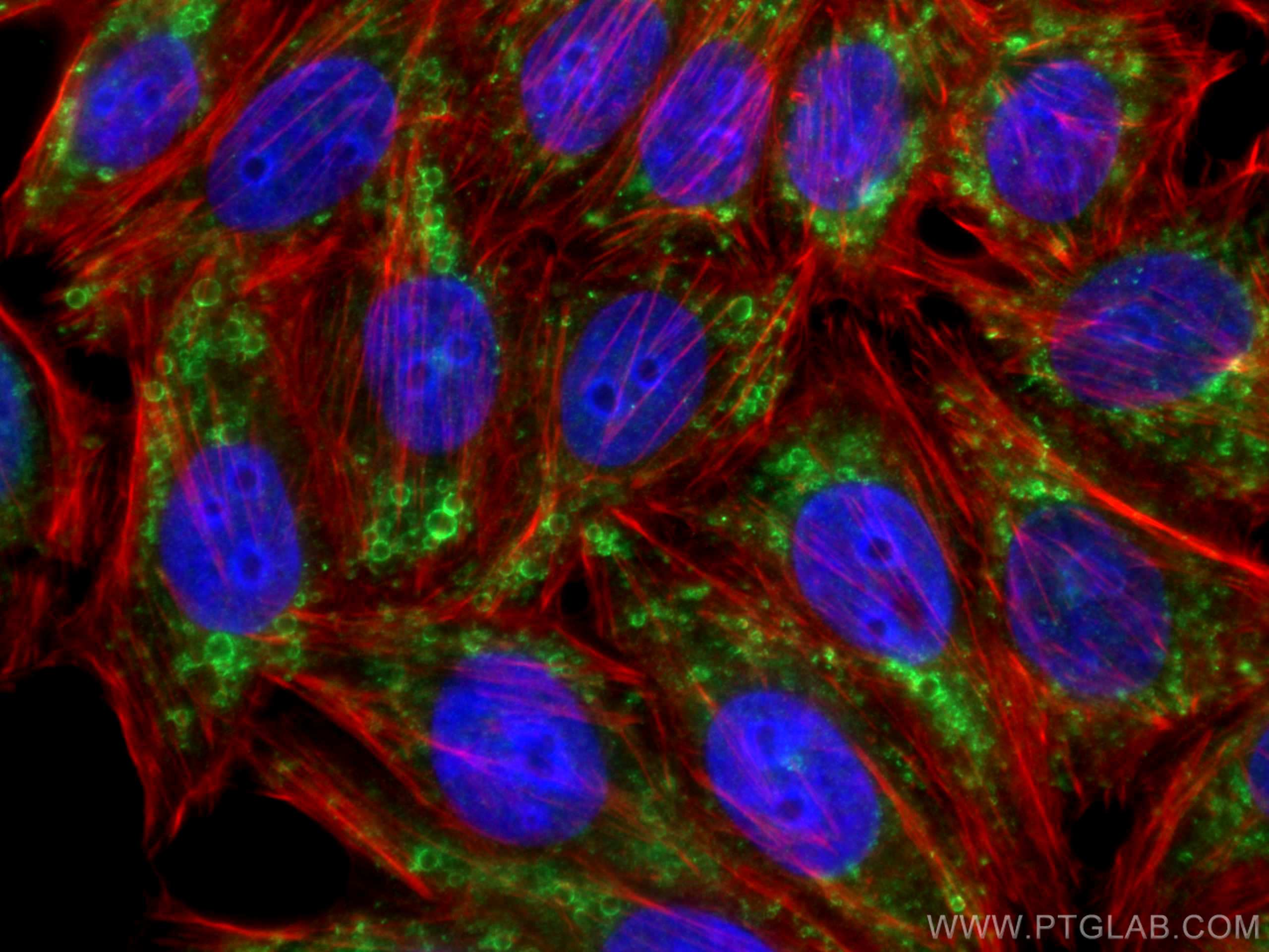 ADRP/Perilipin 2 Rabbit Polyclonal antibody - United Bio Research
