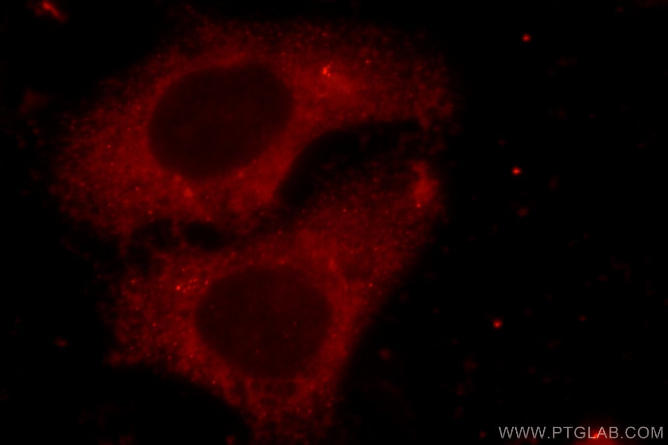 ADRP Fusion Protein Ag7539 | Proteintech