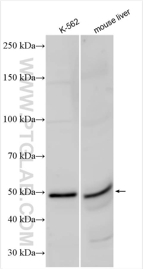 ADRP/Perilipin 2 antibody (15294-1-AP) | Proteintech