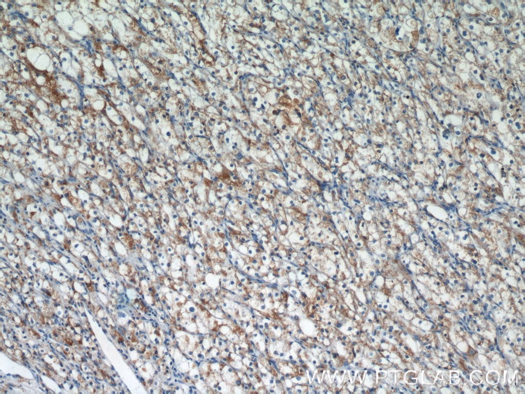 AGER Fusion Protein Ag0818 | Proteintech