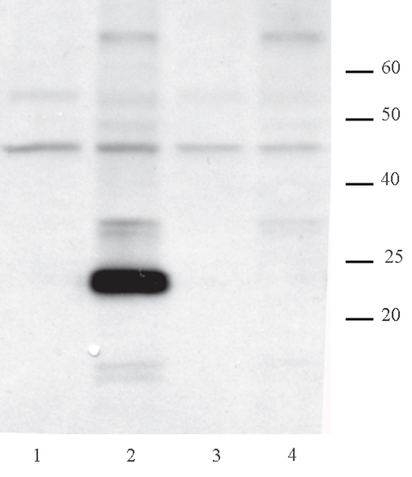 AID antibody (mAb) (Clone 328.8b) | Proteintech