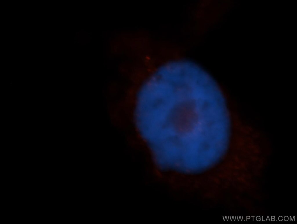 AIFM3 Fusion Protein Ag6278 | Proteintech