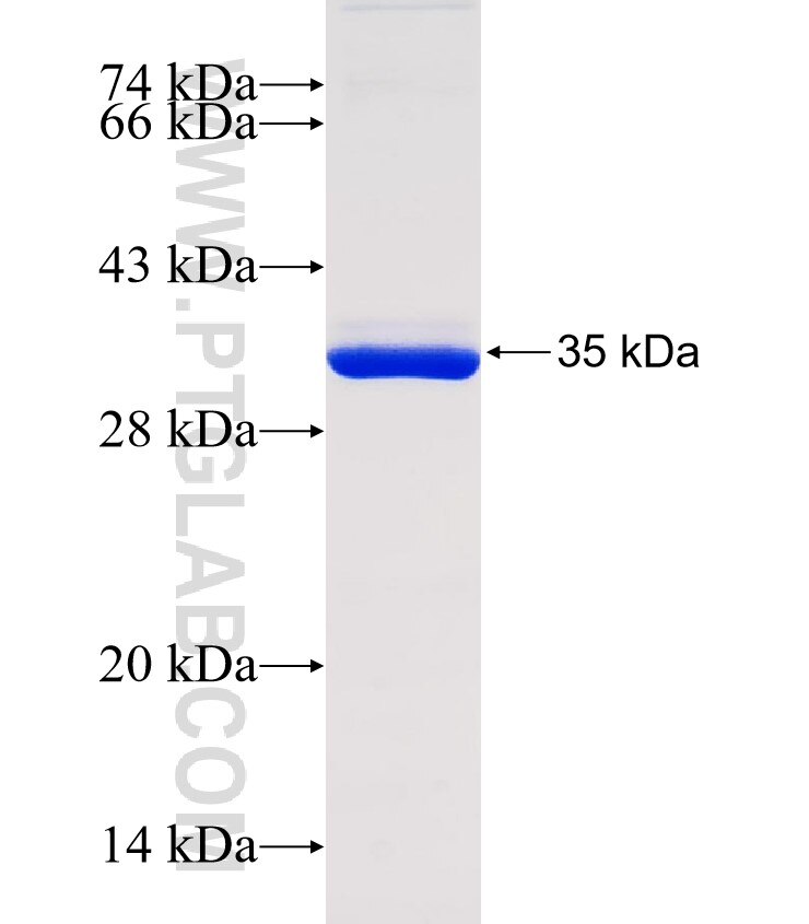 AKT Fusion Protein Ag31760 | Proteintech
