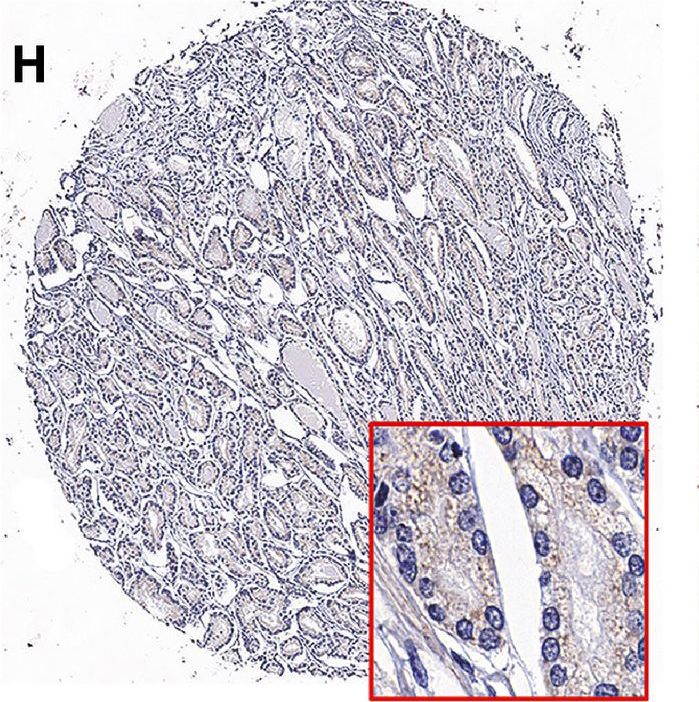 Phospho-AKT (Ser473) Antibody 66444-1-Ig | Proteintech
