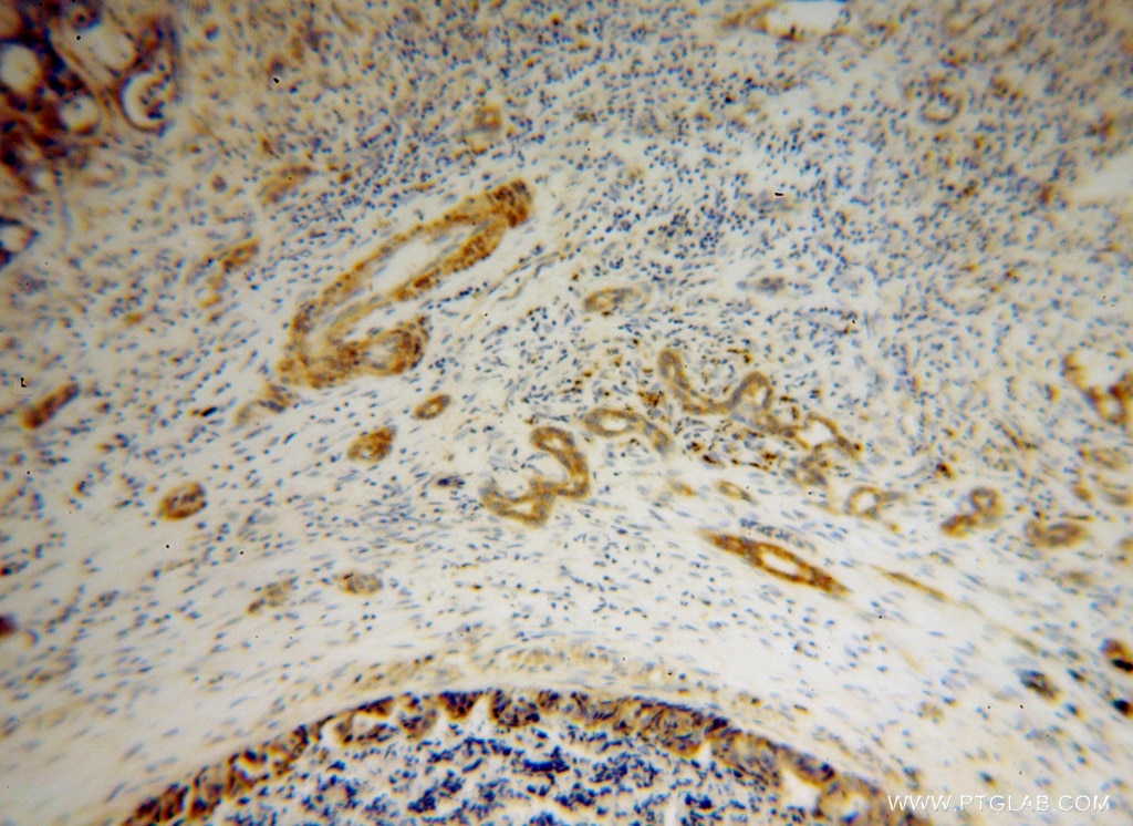 ALDH3A2 Fusion Protein Ag8753 | Proteintech