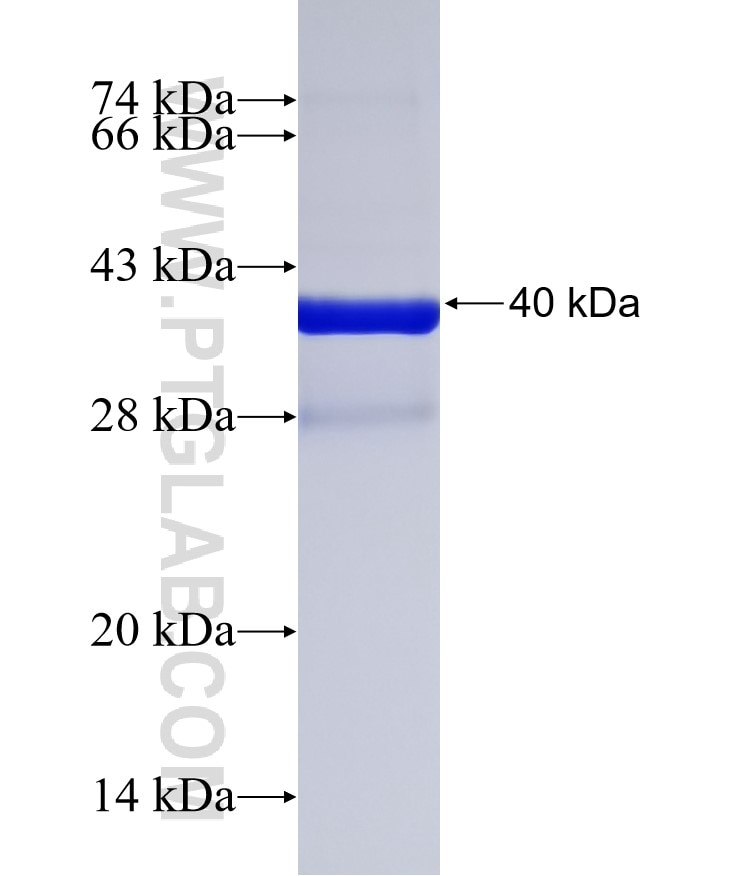 ANGPTL7 Fusion Protein Ag32199 | Proteintech