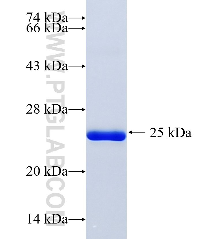 ANK2 Fusion Protein Ag34683 | Proteintech