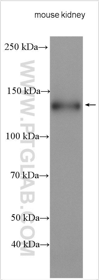 CD13 antibody (14553-1-AP) | Proteintech