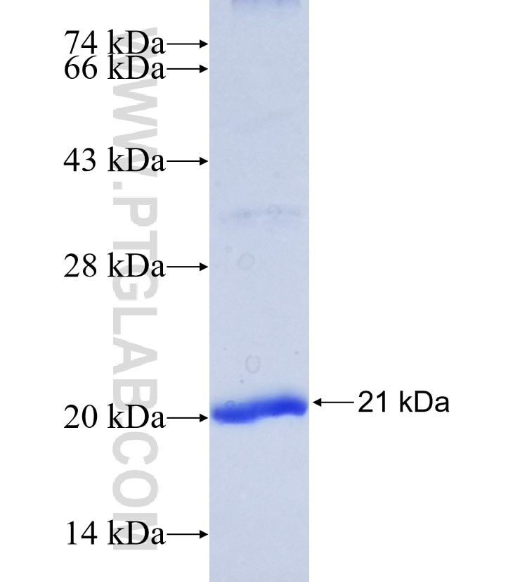 AP1S1 Fusion Protein Ag34776 | Proteintech