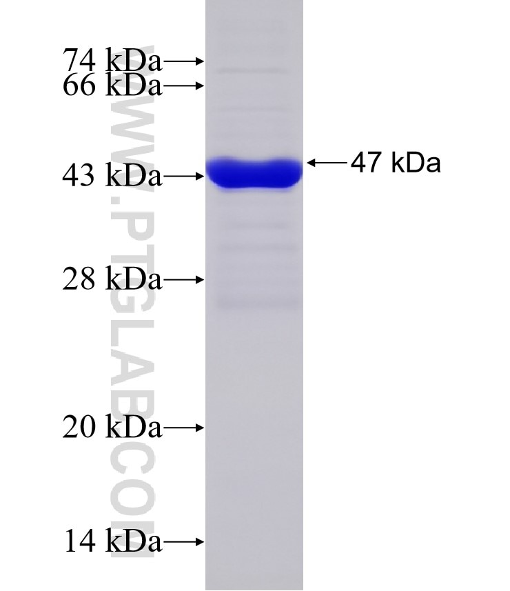 AP4M1 Fusion Protein Ag32301 | Proteintech