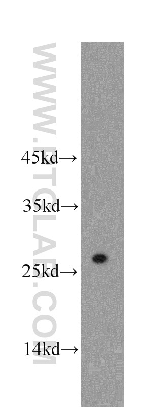 APOBEC2 antibody (20121-1-AP) | Proteintech