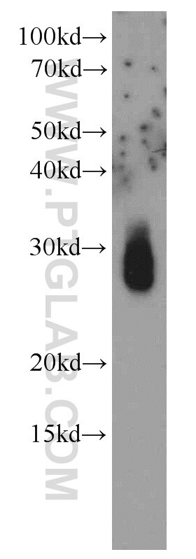 APOD Fusion Protein Ag0812 | Proteintech