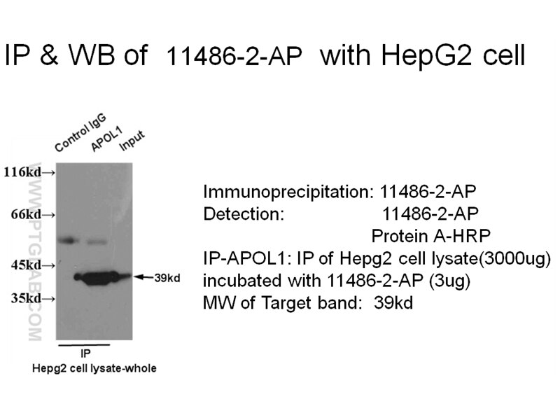 APOL1 Fusion Protein Ag2016 | Proteintech