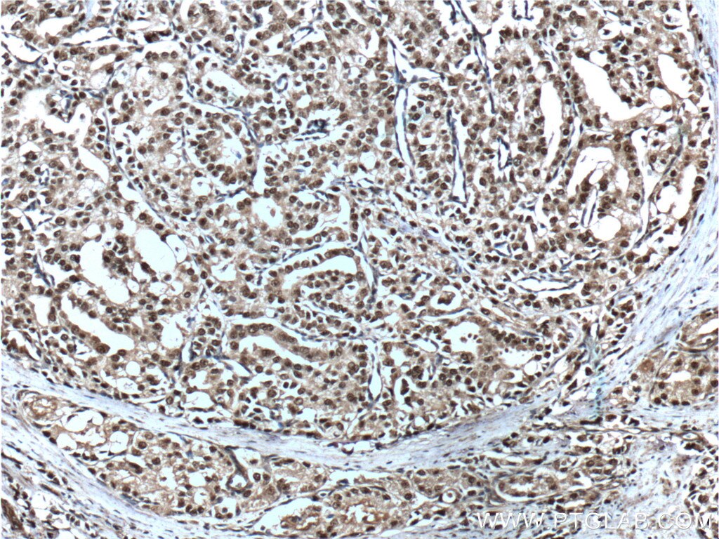 androgen receptor antibody (22089-1-AP) | Proteintech