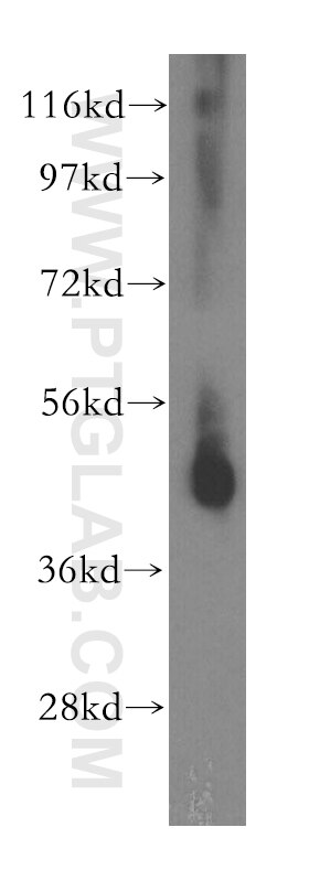 ASS1 antibody (16210-1-AP) | Proteintech