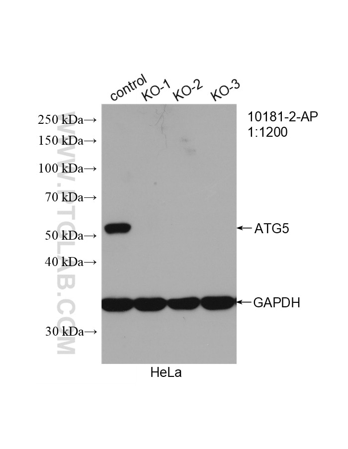 ATG5 antibody (10181-2-AP) | Proteintech