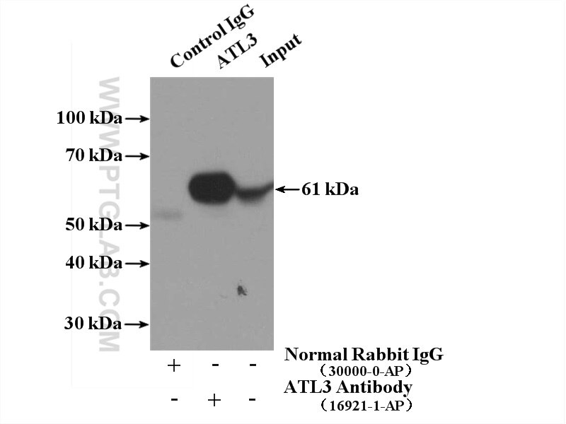 ATL3 antibody (16921-1-AP) | Proteintech