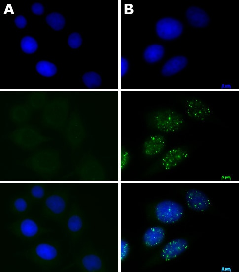 ATM phospho Ser1981 antibody (mAb) (Clone 10H11.E.12) | Proteintech