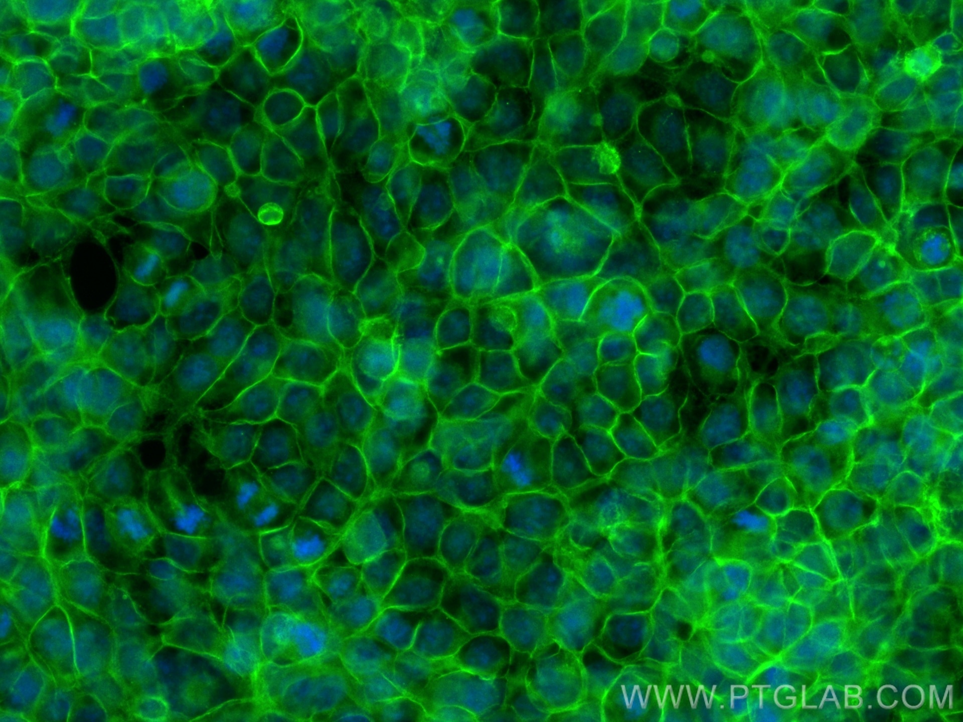 ATP1A1 antibody (14418-1-AP) | Proteintech