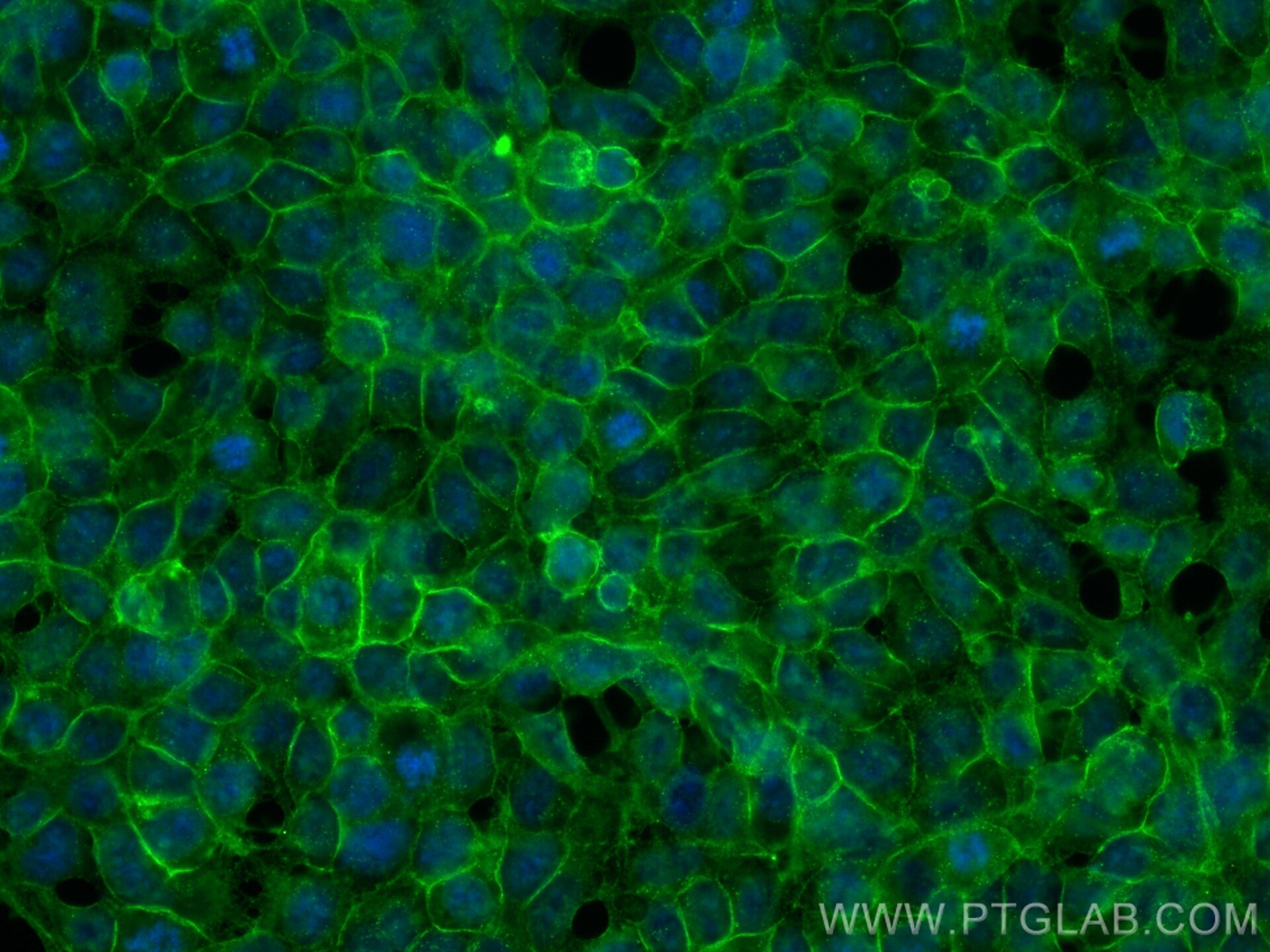 ATP1A1-Specific antibody (55187-1-AP) | Proteintech