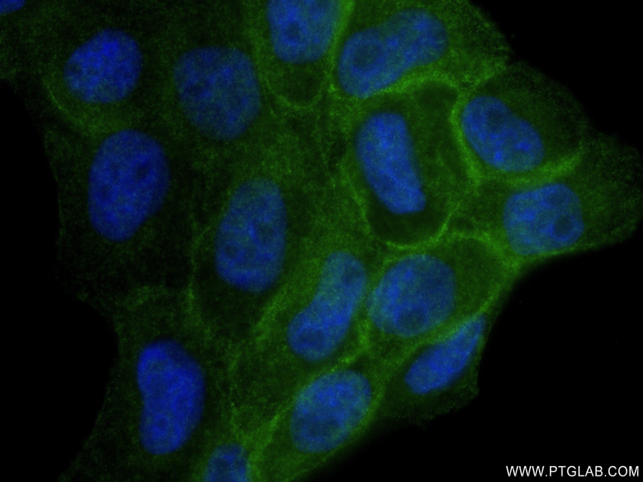 ATP1A1 antibody (83191-5-RR) | Proteintech