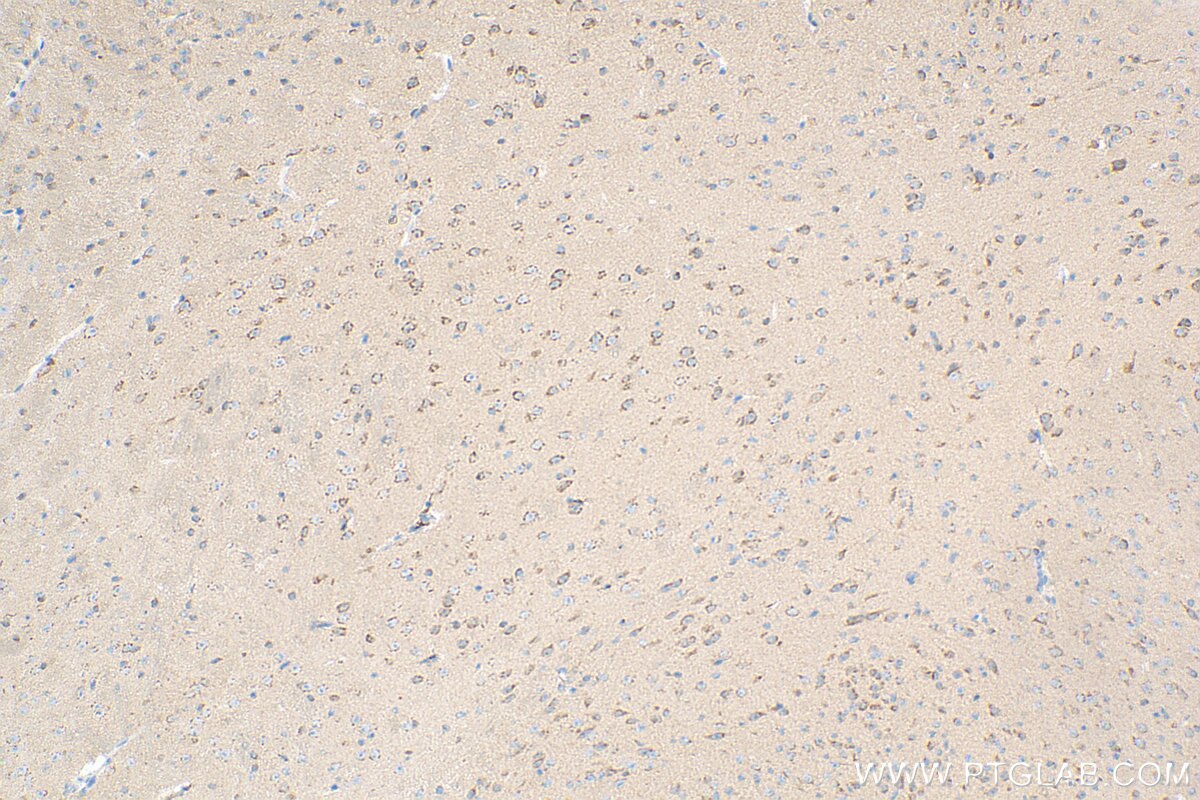 CD57 antibody (19401-1-AP) | Proteintech