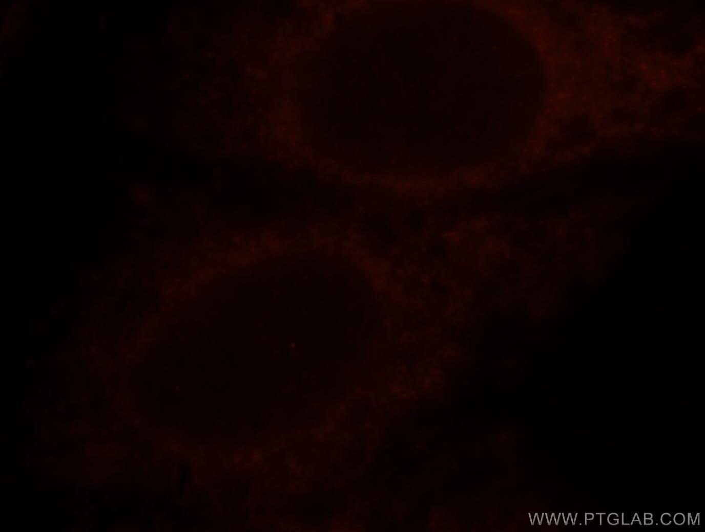 BAD Fusion Protein Ag21382 | Proteintech