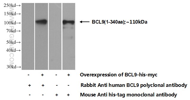 BCL9 Fusion Protein Ag19069 | Proteintech