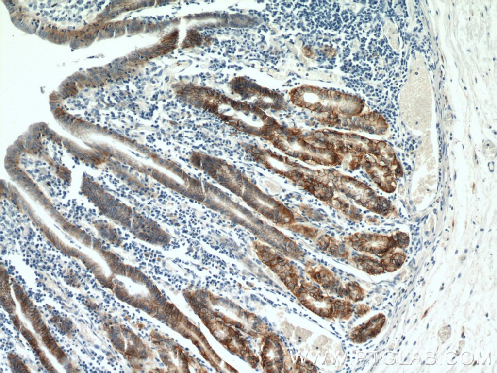 CA9 Fusion Protein Ag1540 | Proteintech