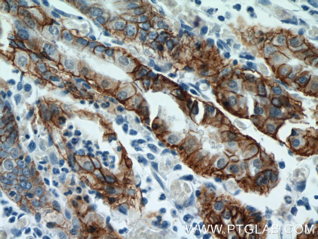 CA9 Antibody 11443-1-AP | Proteintech