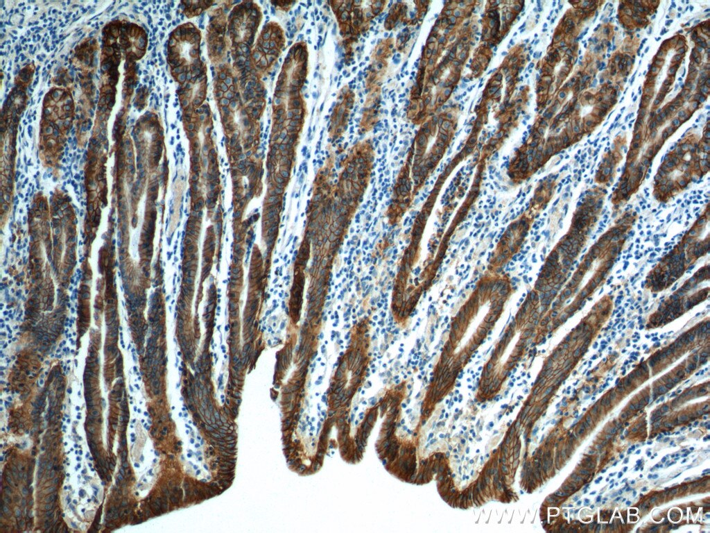 CA9 antibody (11443-1-AP) | Proteintech