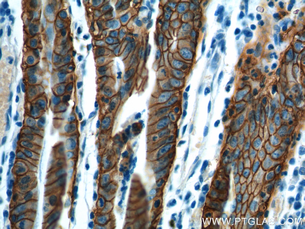 CA9 antibody (11443-1-AP) | Proteintech