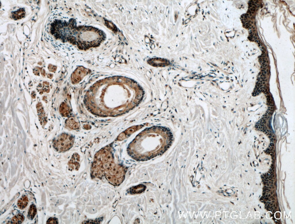 CARD14 antibody (10400-1-AP) | Proteintech