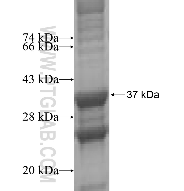 CC10 Fusion Protein Ag7913 | Proteintech
