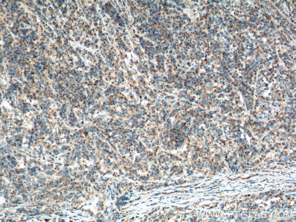 MIP-3 Beta antibody (13397-1-AP) | Proteintech