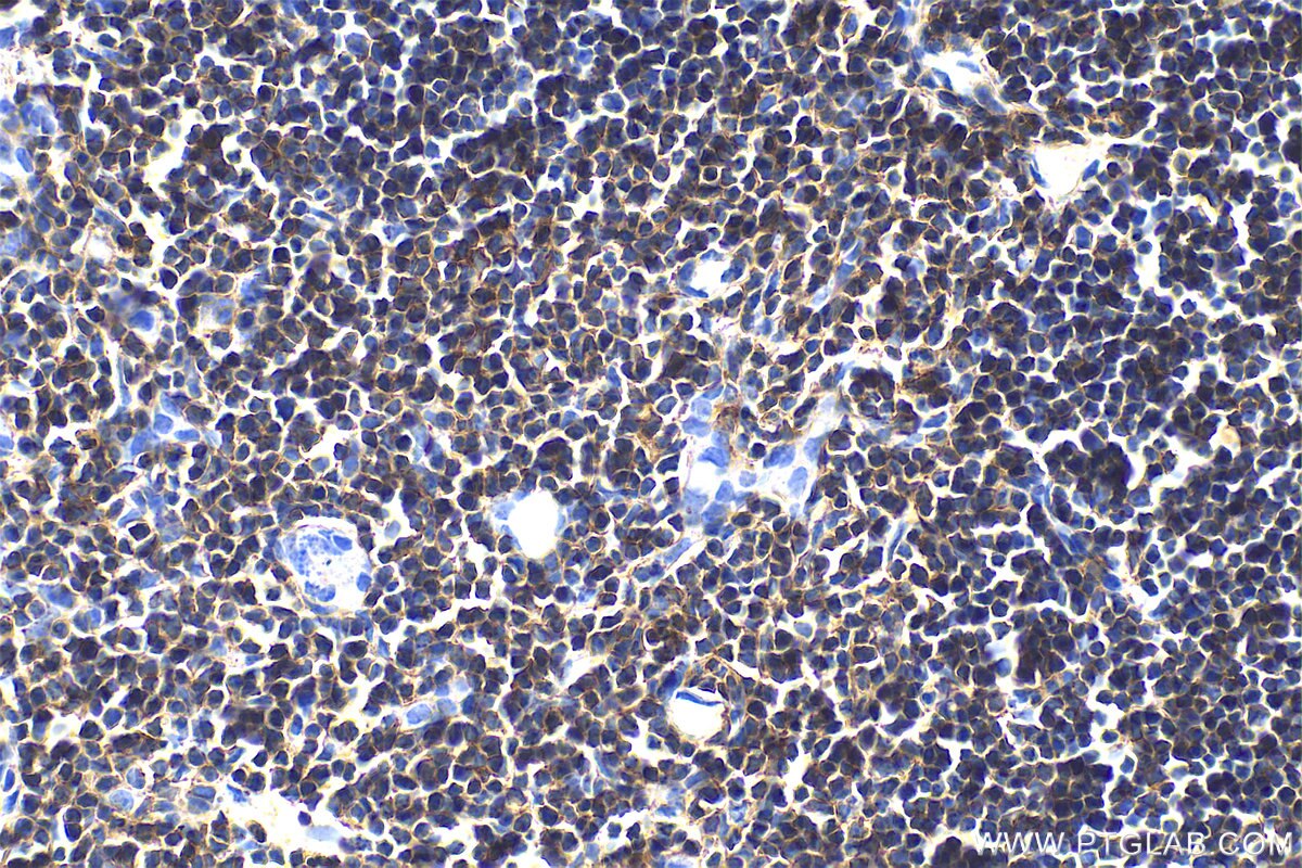 CD229/SLAMF3 antibody (32666-1-AP) | Proteintech