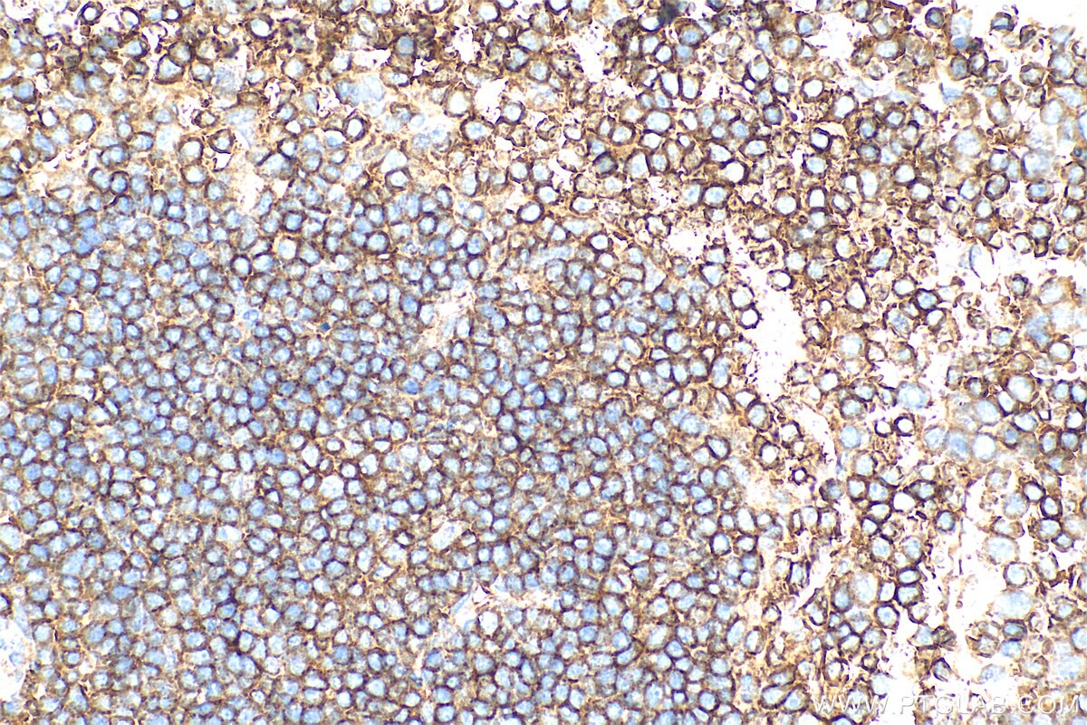 CD229/SLAMF3 antibody (32666-1-AP) | Proteintech