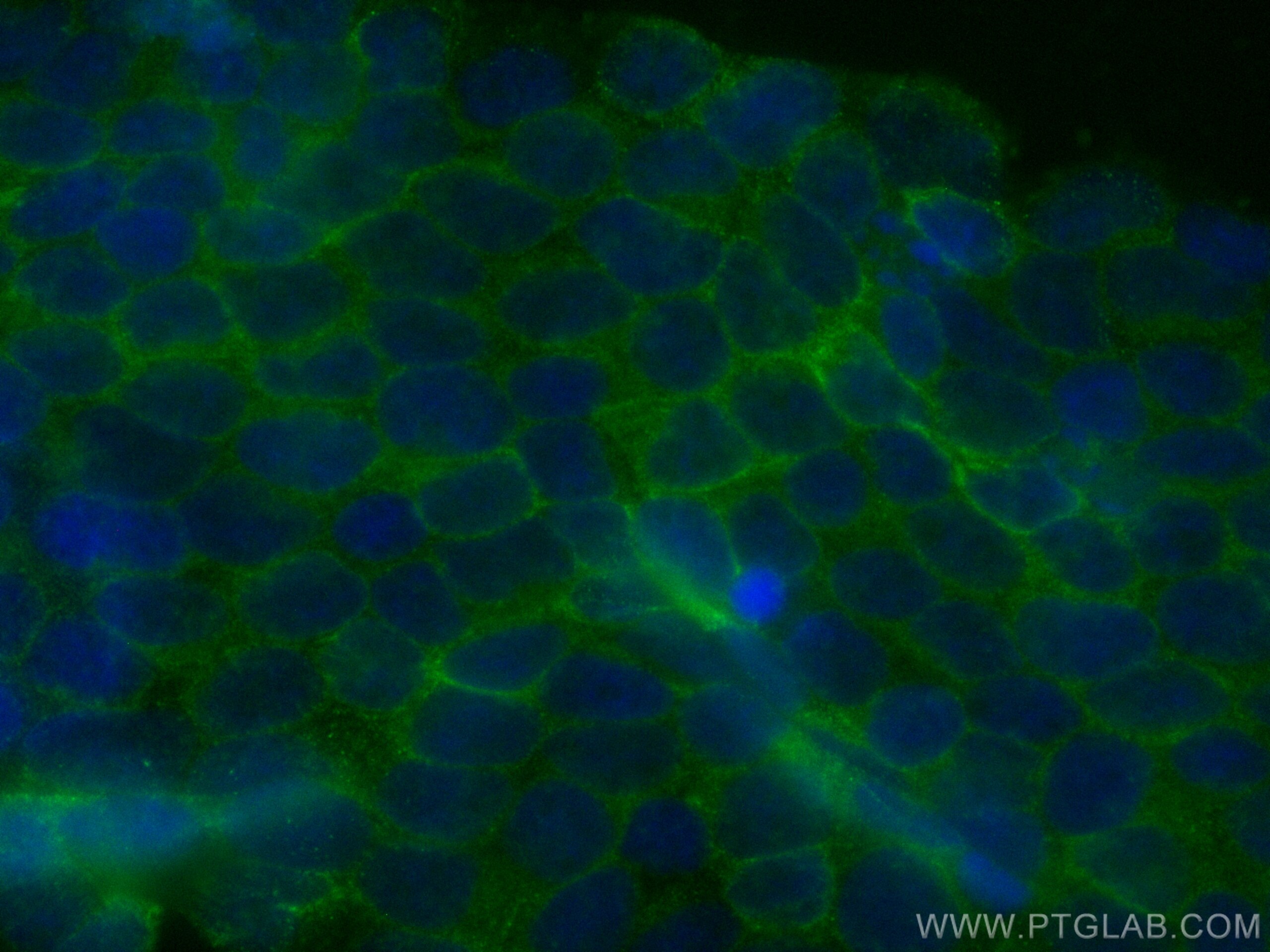 CD247 antibody (CL488-12837) | Proteintech