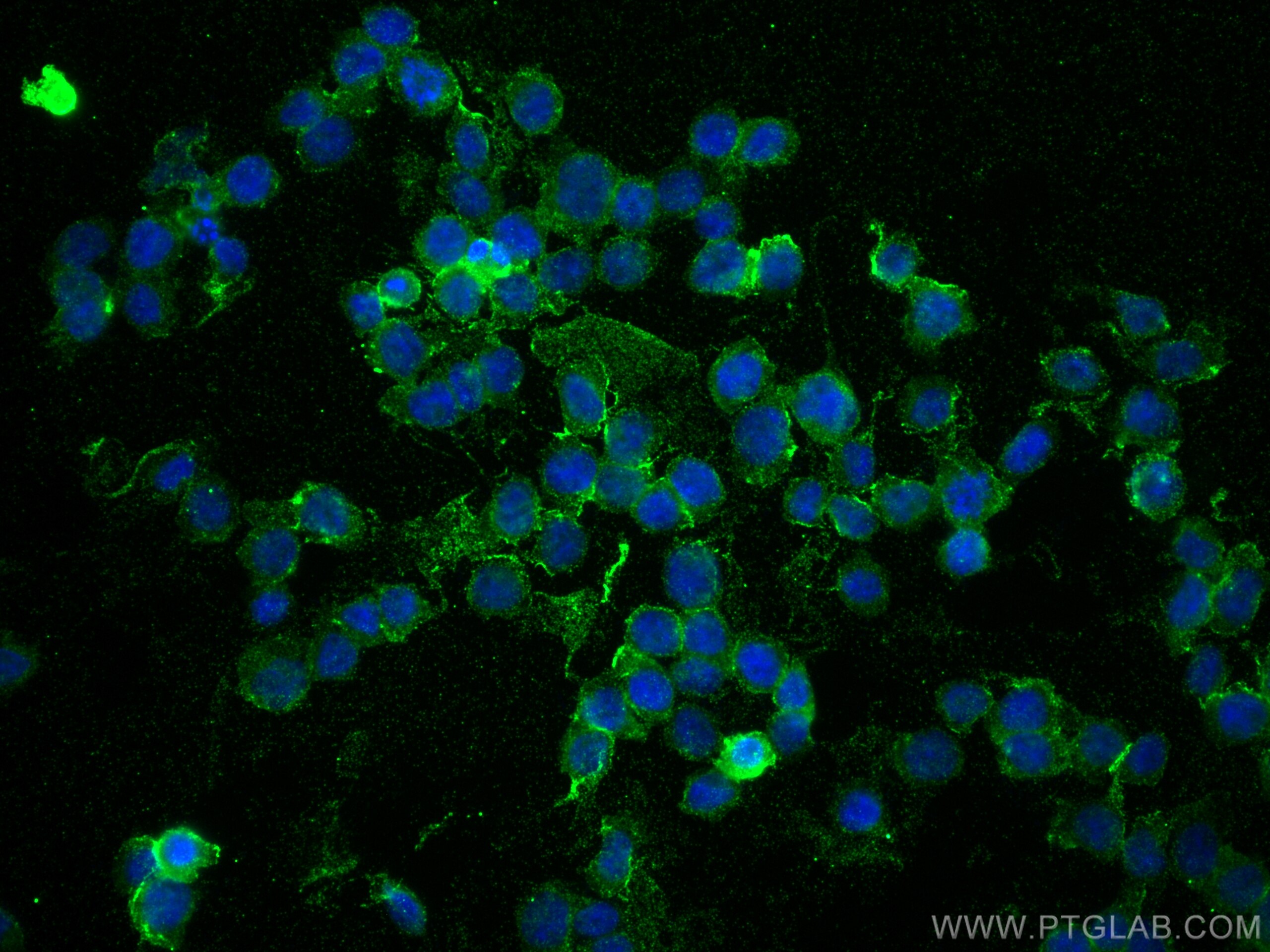CD36 antibody (66395-1-Ig) | Proteintech