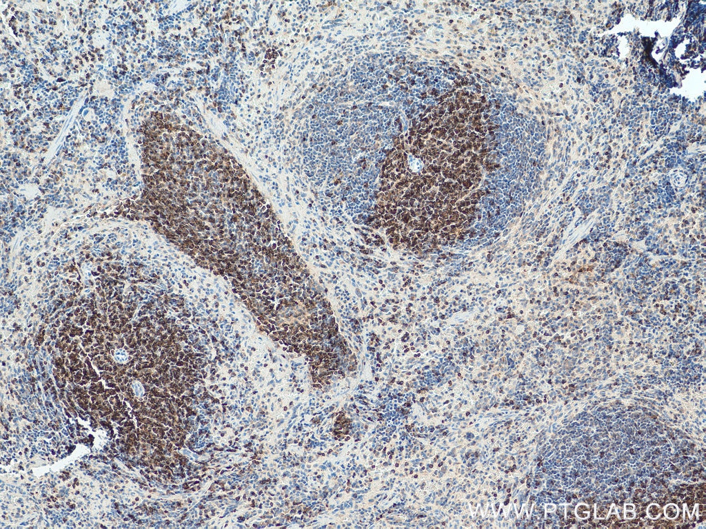 CD3 antibody (17617-1-AP) | Proteintech